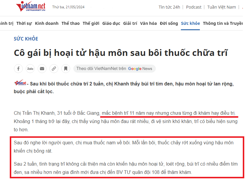 Đốt trĩ Laser, Longo, HCPT II: 3 Phương Pháp Cắt Trĩ Phổ Biến Nhất Hiện Nay